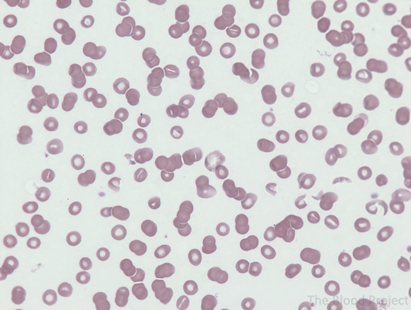Rouleaux • The Blood Project