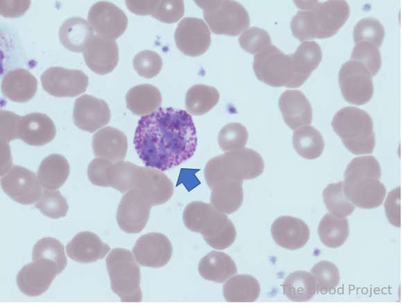 Basophils Definition