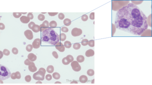 Toxic Granulation • The Blood Project