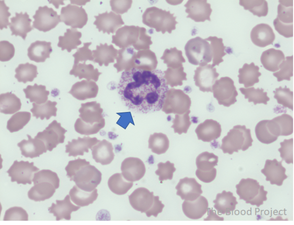 Toxic Granulation • The Blood Project