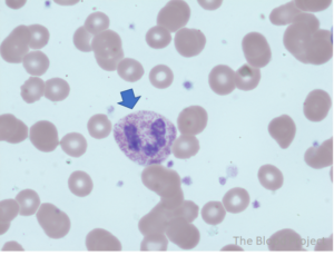 Toxic Granulation • The Blood Project