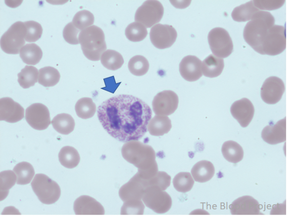 Toxic Granulation • The Blood Project