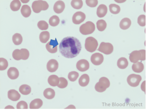 Döhle Bodies • The Blood Project