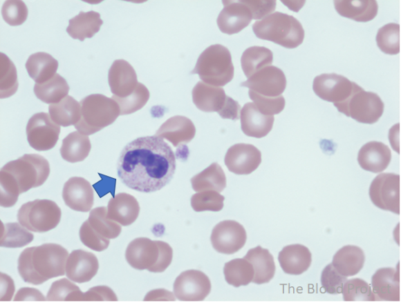 Döhle Bodies • The Blood Project