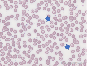 Target Cells • The Blood Project