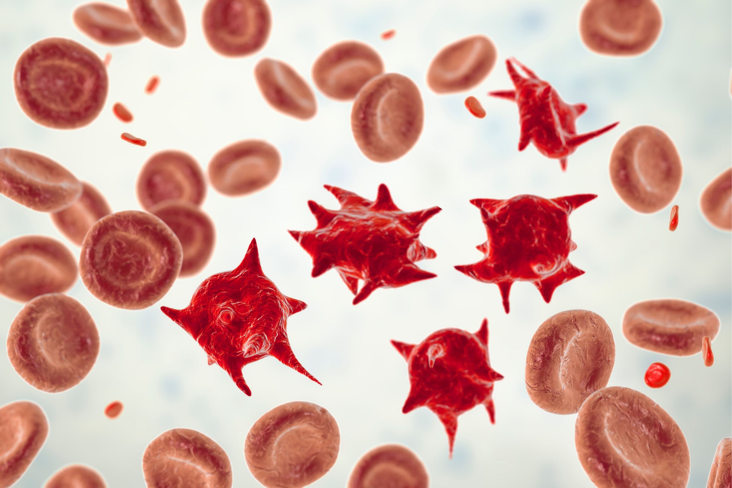 What is an acanthocyte? • The Blood Project