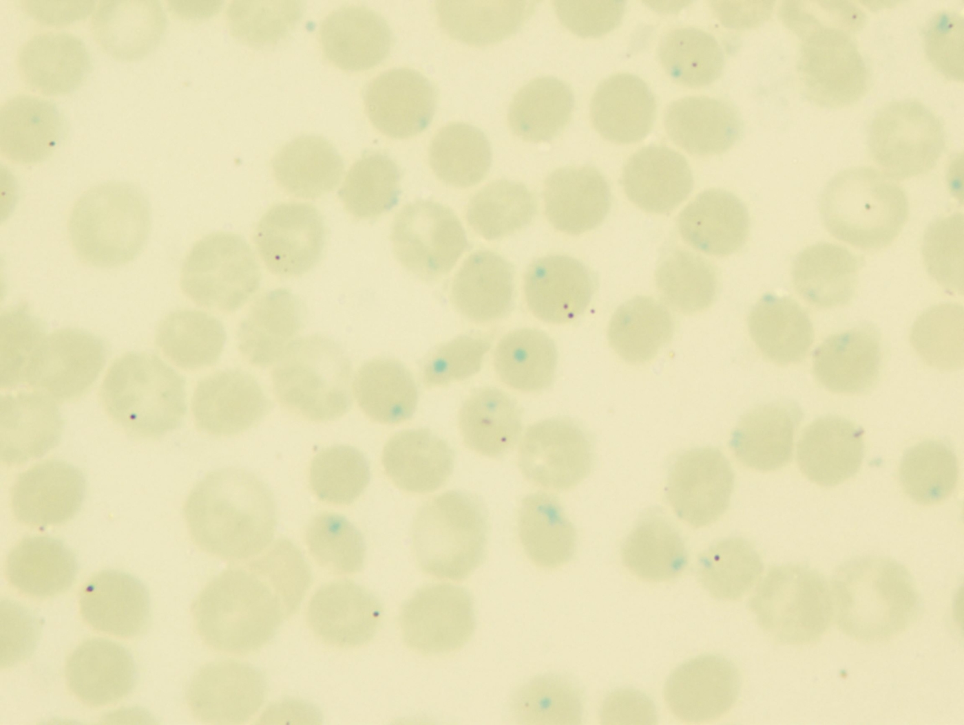 Heinz Bodies • The Blood Project