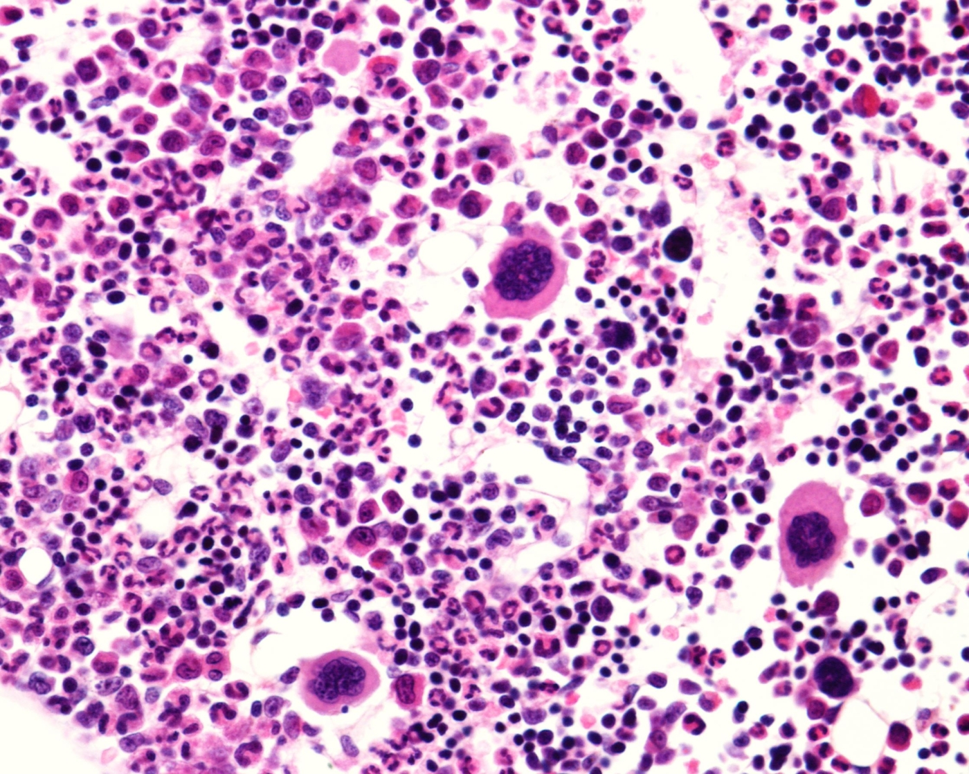 Megakaryocytes • The Blood Project