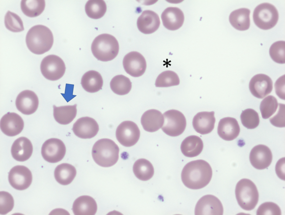 Labs • The Blood Project