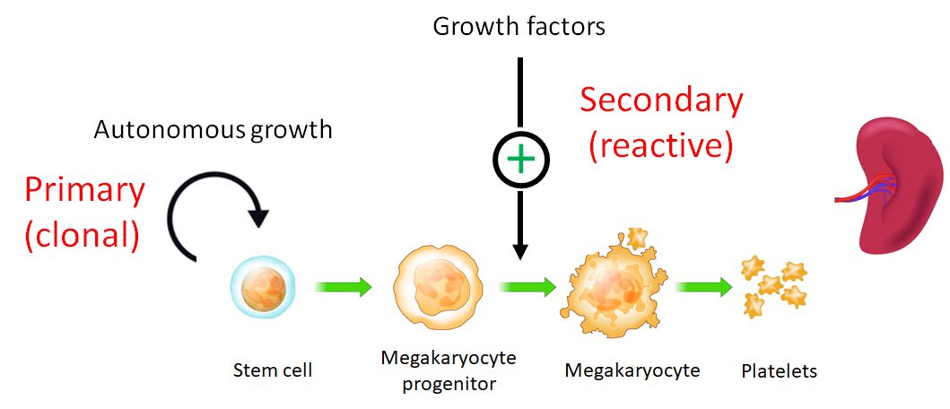 What is the difference between primary and secondary thrombocytosis ...