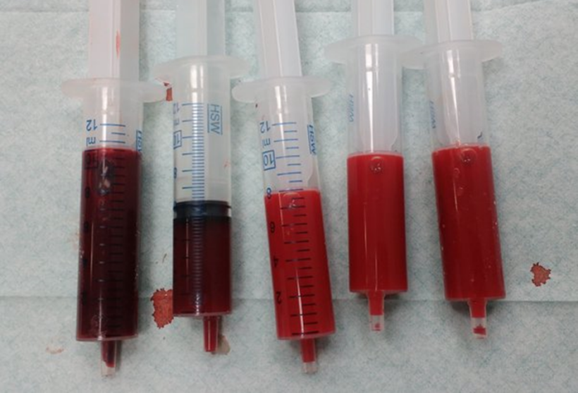 Did You Know That Not All Blood is Red? • The Blood Project