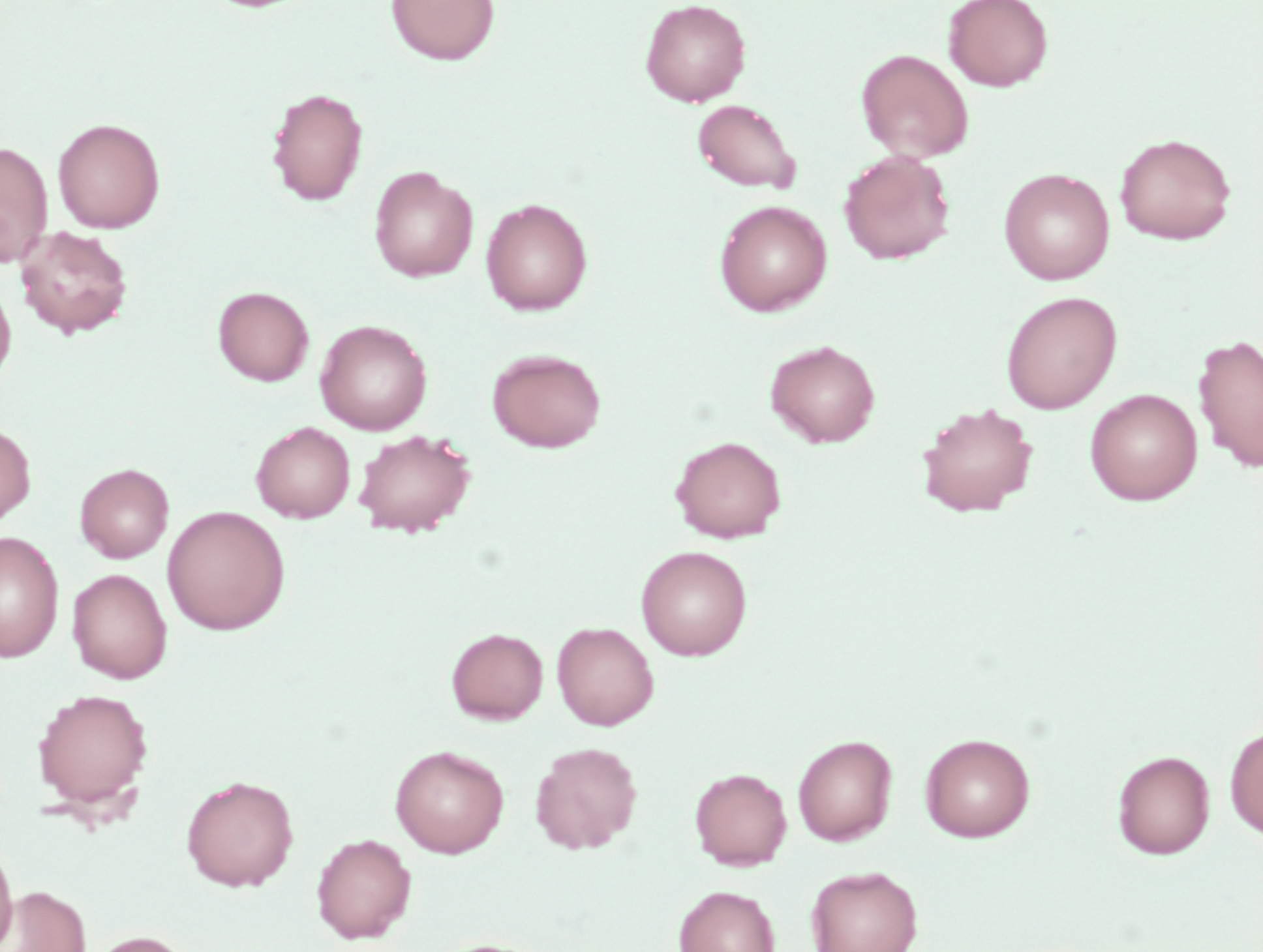 Labs • The Blood Project