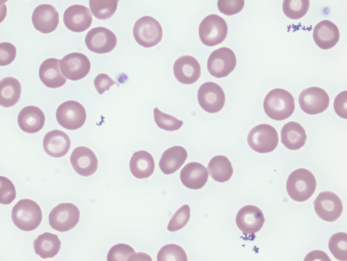 Labs • The Blood Project