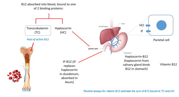 Workings backward from an elevated MCV • The Blood Project
