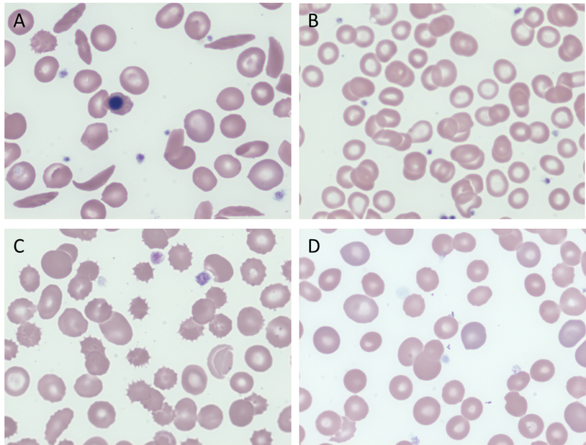 Imaging and Labs • The Blood Project