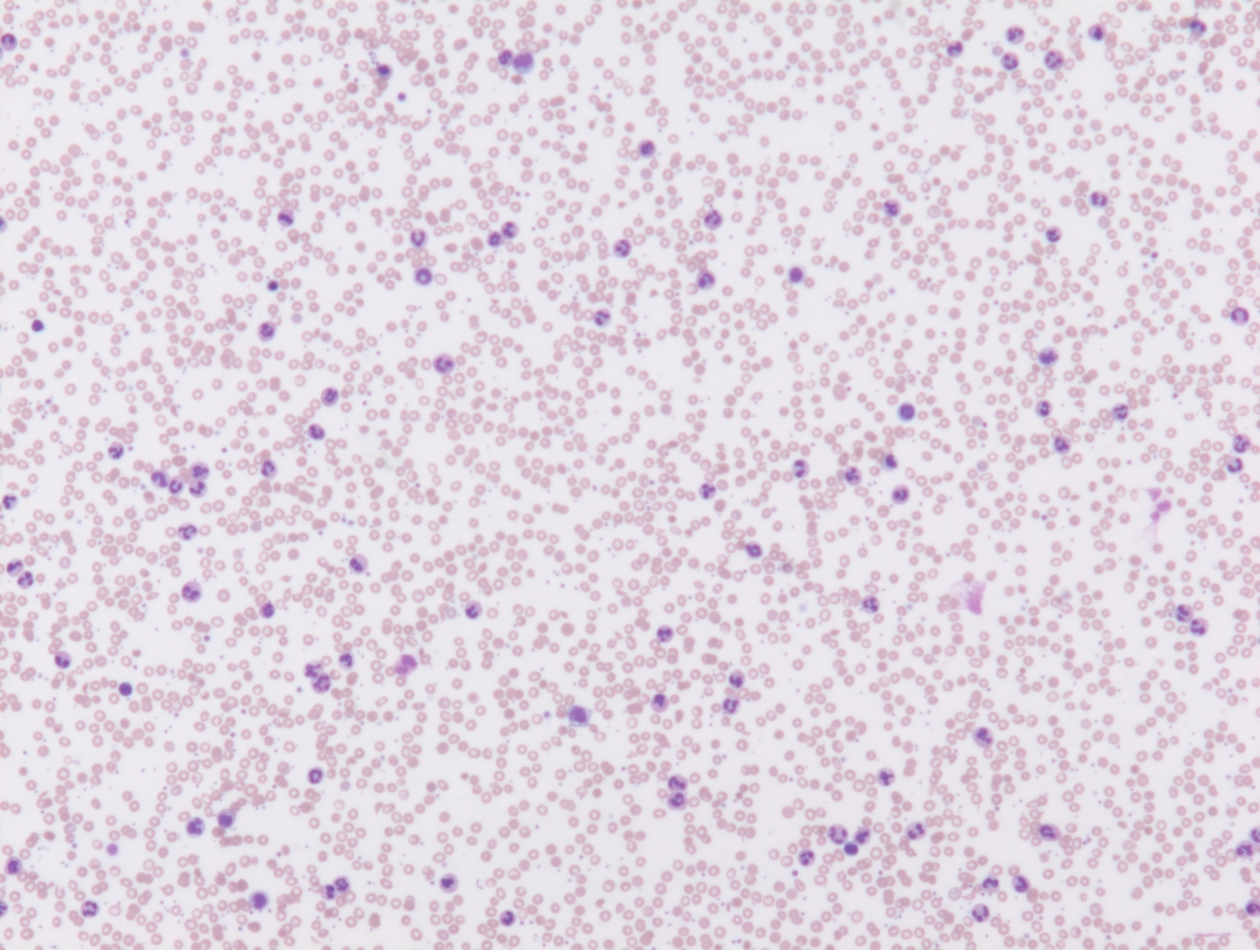 Peripheral smear quiz • The Blood Project