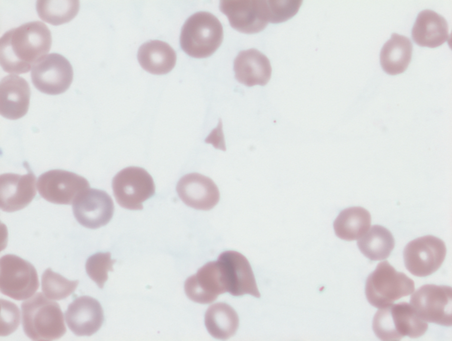Peripheral smear quiz • The Blood Project