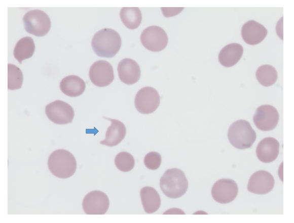 Labs • The Blood Project