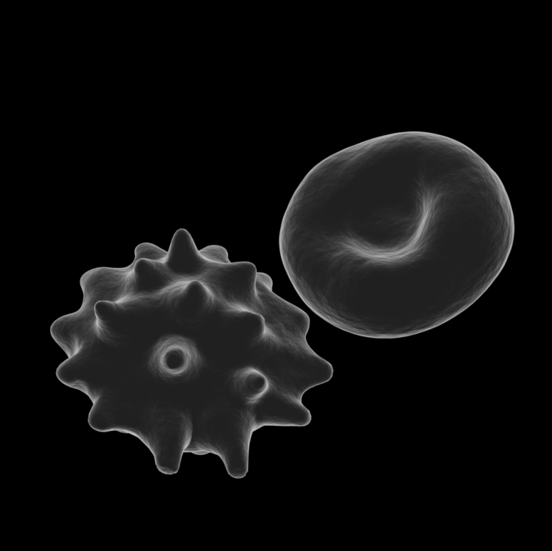 Echinocyte (Burr Cell) • The Blood Project