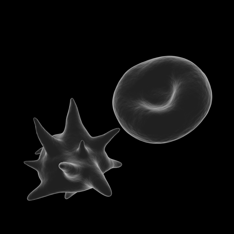 Acanthocyte (Spur Cell) • The Blood Project