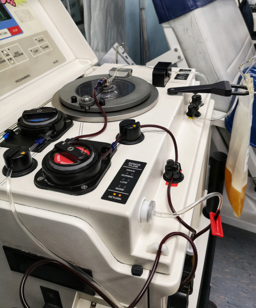 Therapeutic Plasma Exchange in TTP • The Blood Project