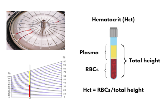 How is the hematocrit (Hct) measured? • The Blood Project
