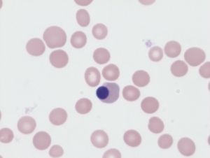 How are nucleated RBCs (nRBCs) counted? • The Blood Project