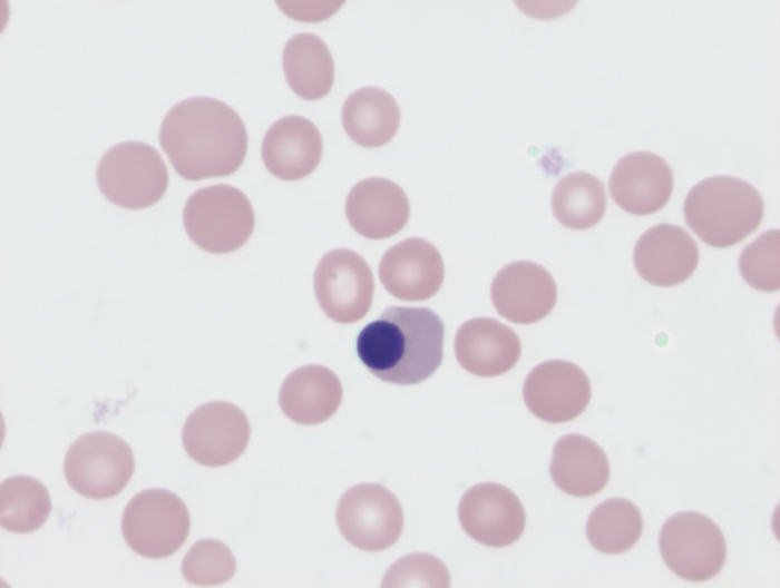 How are nucleated RBCs (nRBCs) counted? • The Blood Project