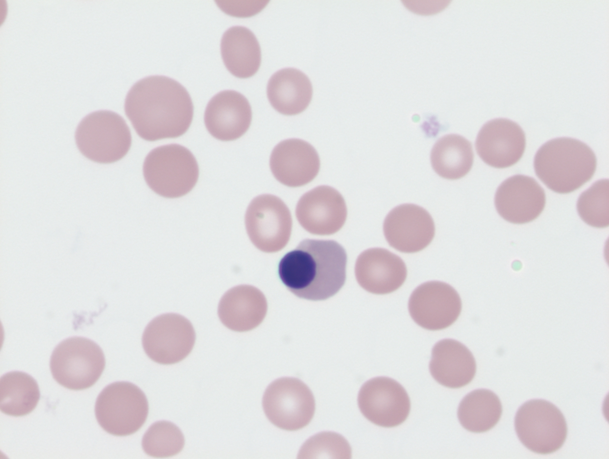 How are nucleated RBCs (nRBCs) counted? • The Blood Project