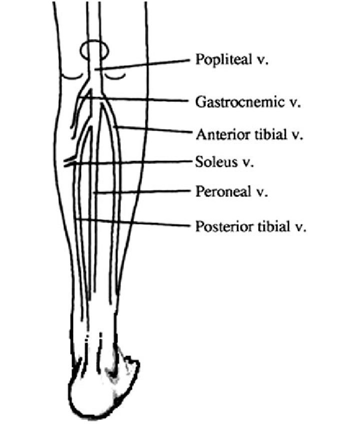 Gastrocnemius Soleal Vein