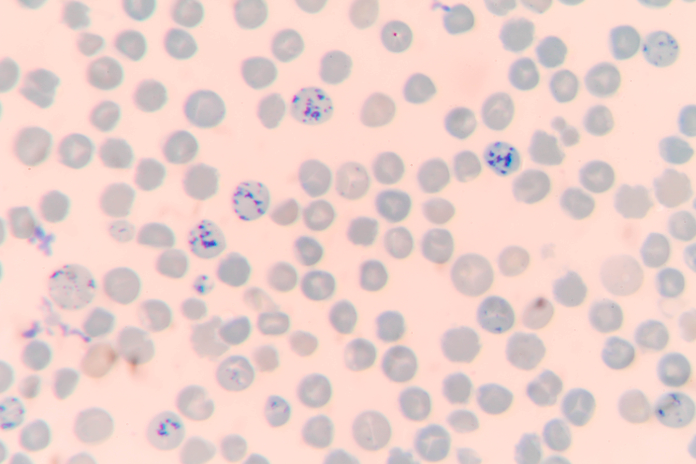 Retics_Sam • The Blood Project