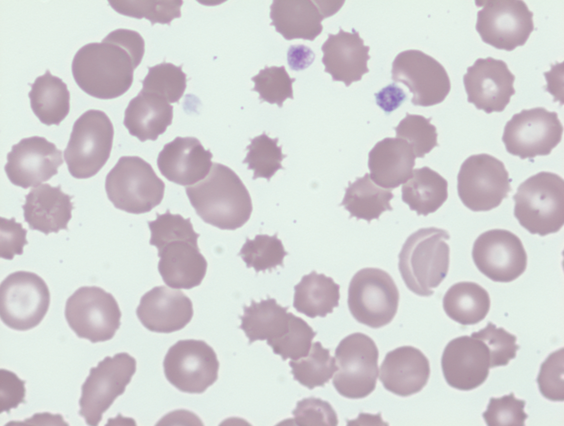 Postscript • The Blood Project