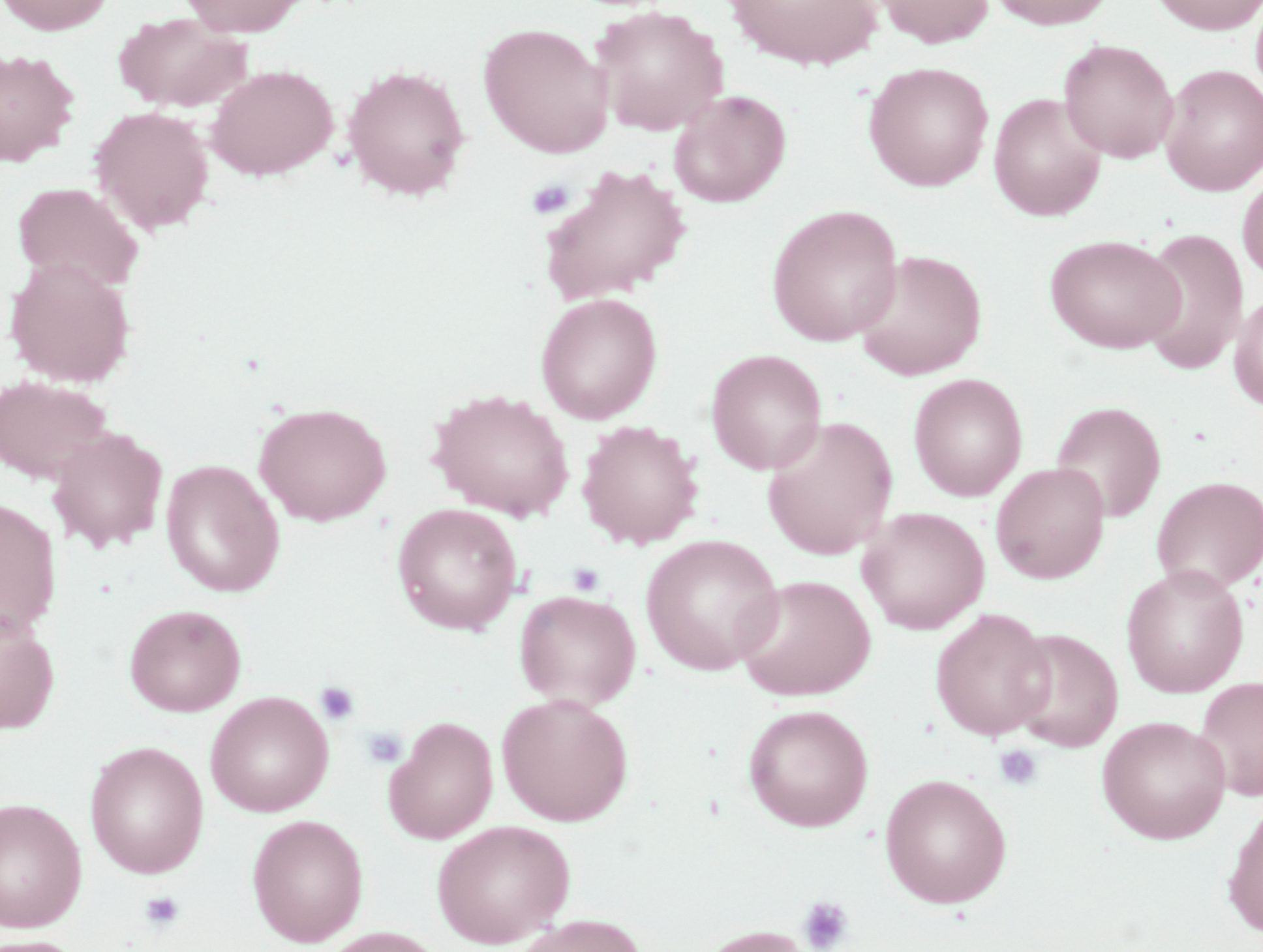 Postscript • The Blood Project