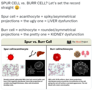 Spur vs. Burr Cells • The Blood Project