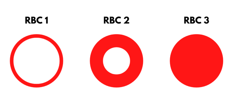 Hemolysis Case 1 • The Blood Project