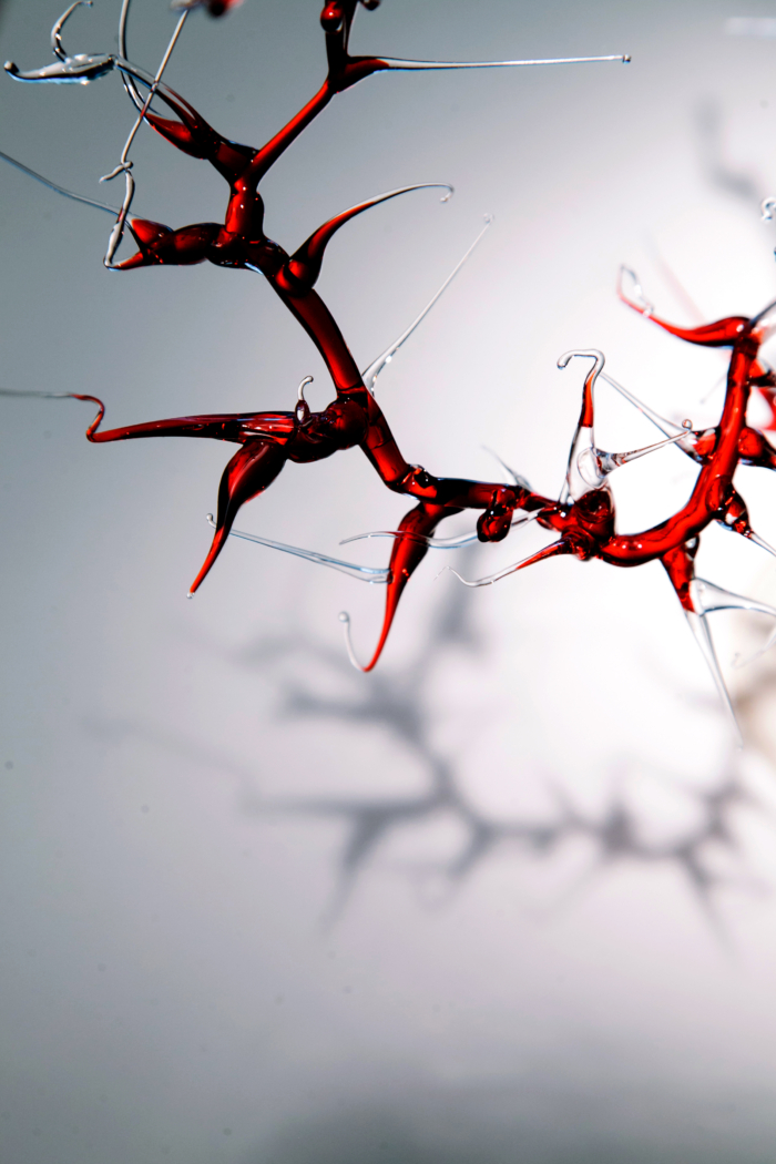 Cerebral Arteries • The Blood Project