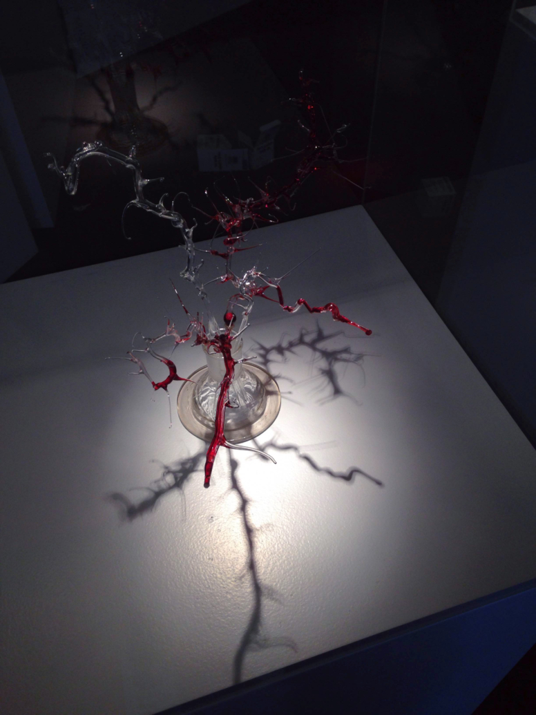 Cerebral Arteries • The Blood Project