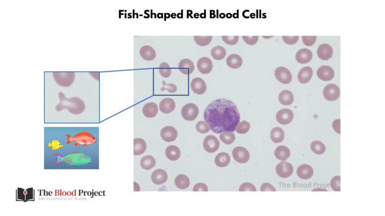 Fish-Shaped Red Blood Cells • The Blood Project