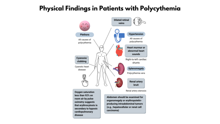 Physical Findings in Patients with Polycythemia • The Blood Project
