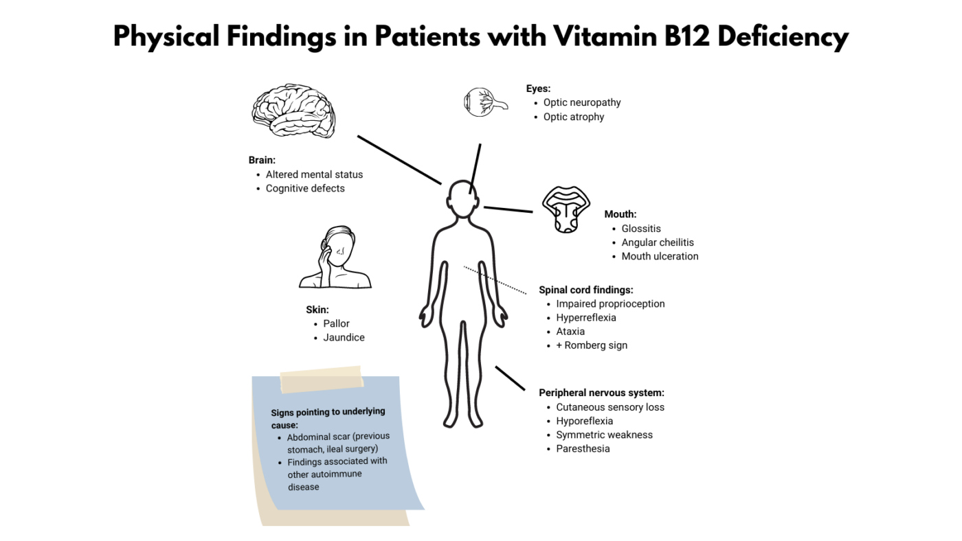 Physical Findings in Patients with Vitamin B12 Deficiency • The Blood ...
