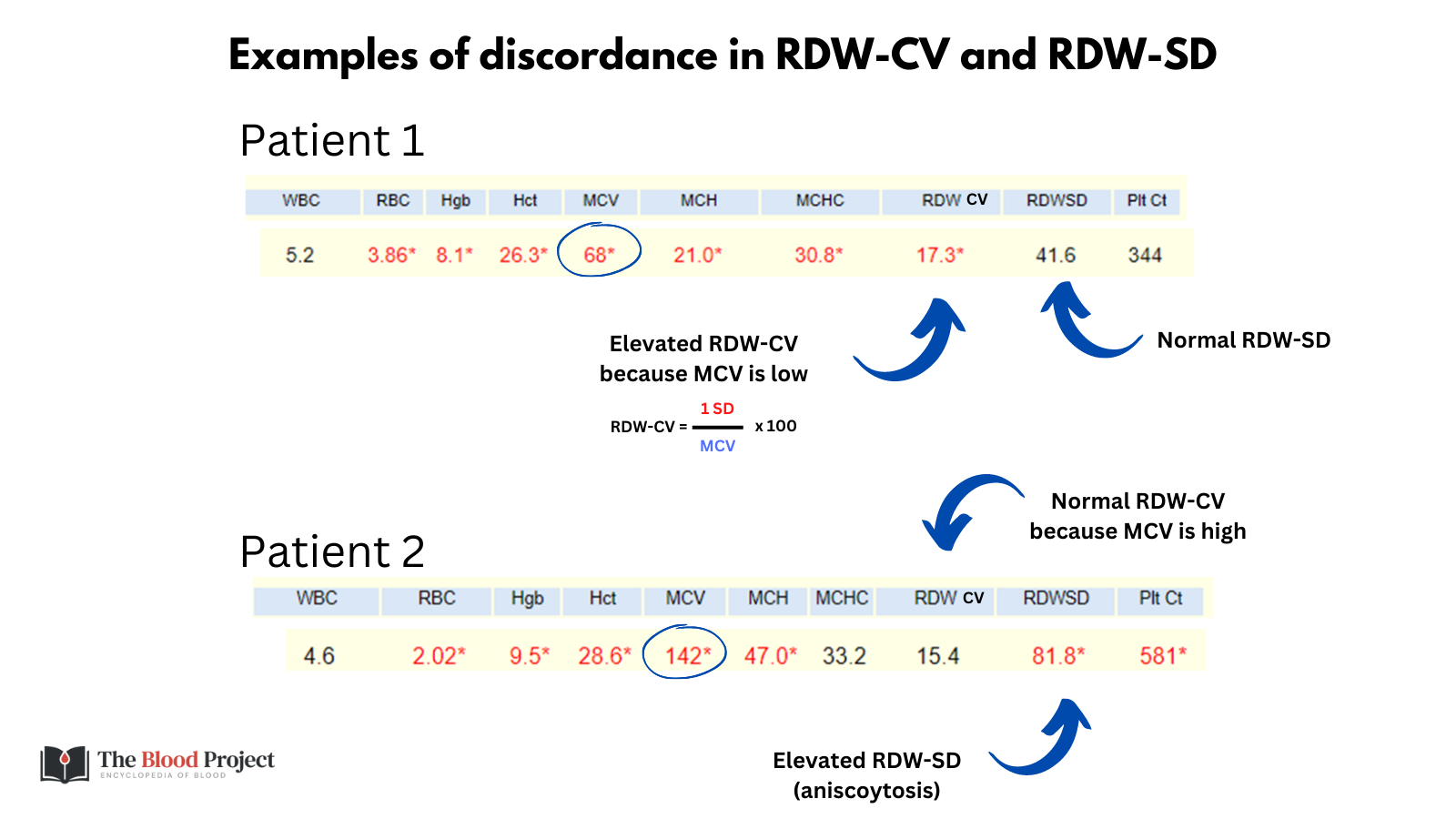 Red Cell Distribution Width (RDW) • The Blood Project