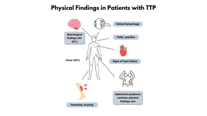 Physical Findings in Patients with TTP • The Blood Project