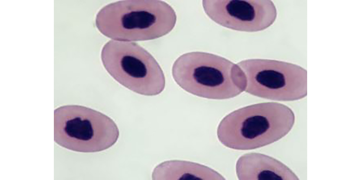 Anucleate vs. Nucleated RBCs • The Blood Project
