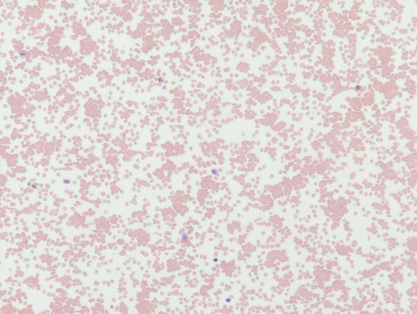 Knowledge Check • The Blood Project