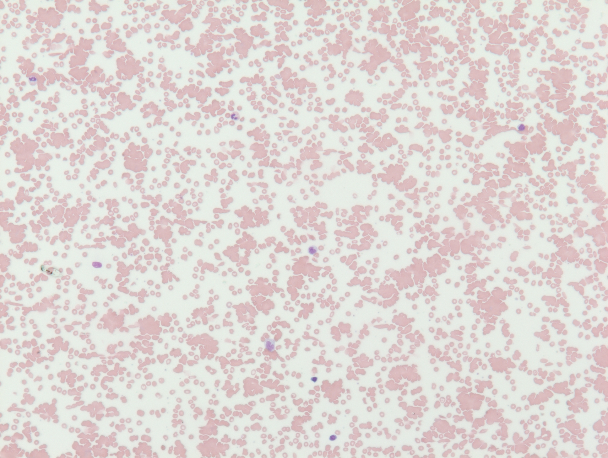 Knowledge Check • The Blood Project