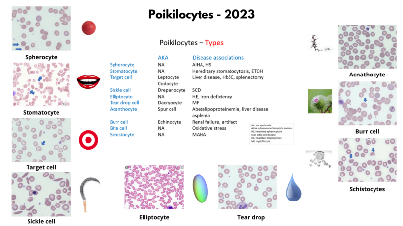 Poikilocytes in History • The Blood Project