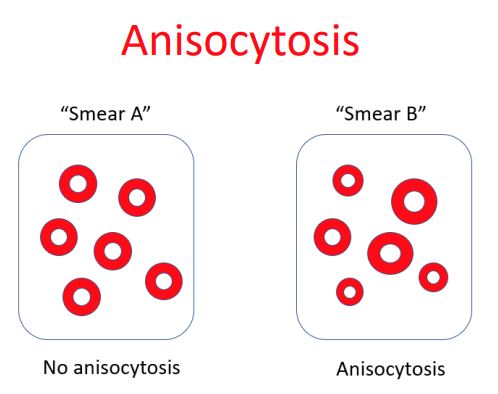 Red Cell Size • The Blood Project