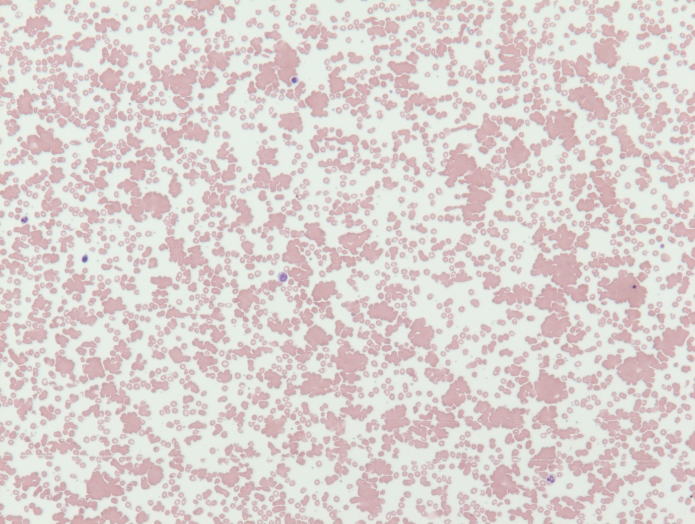 Overview • The Blood Project