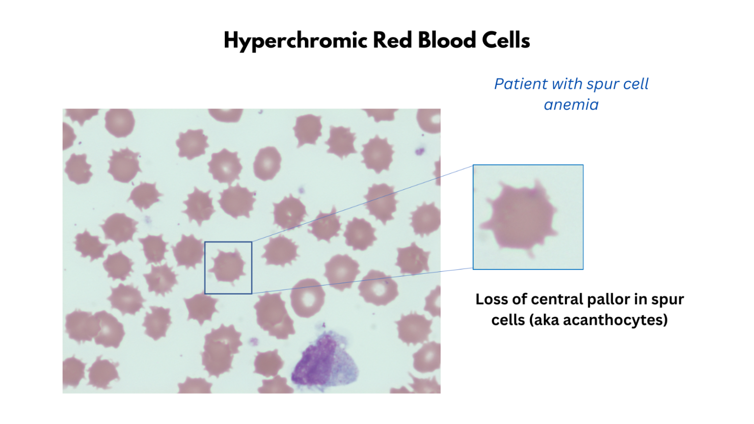 Red Cell Staining (Color) • The Blood Project