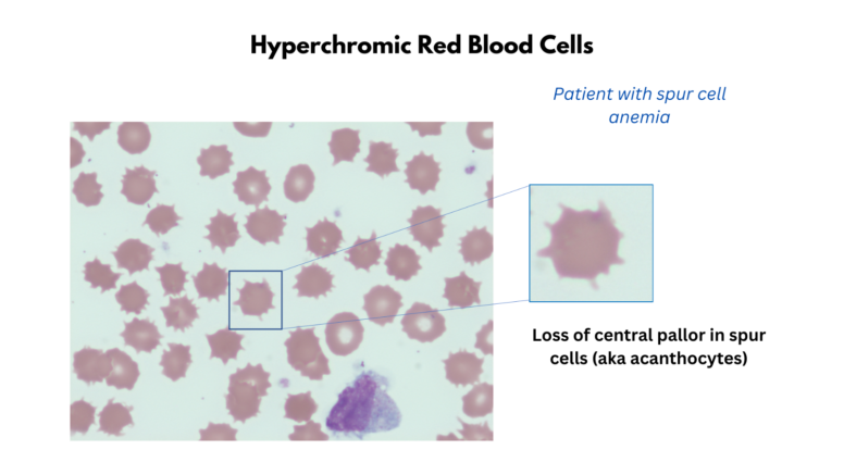 Red Cell Staining (Color) • The Blood Project